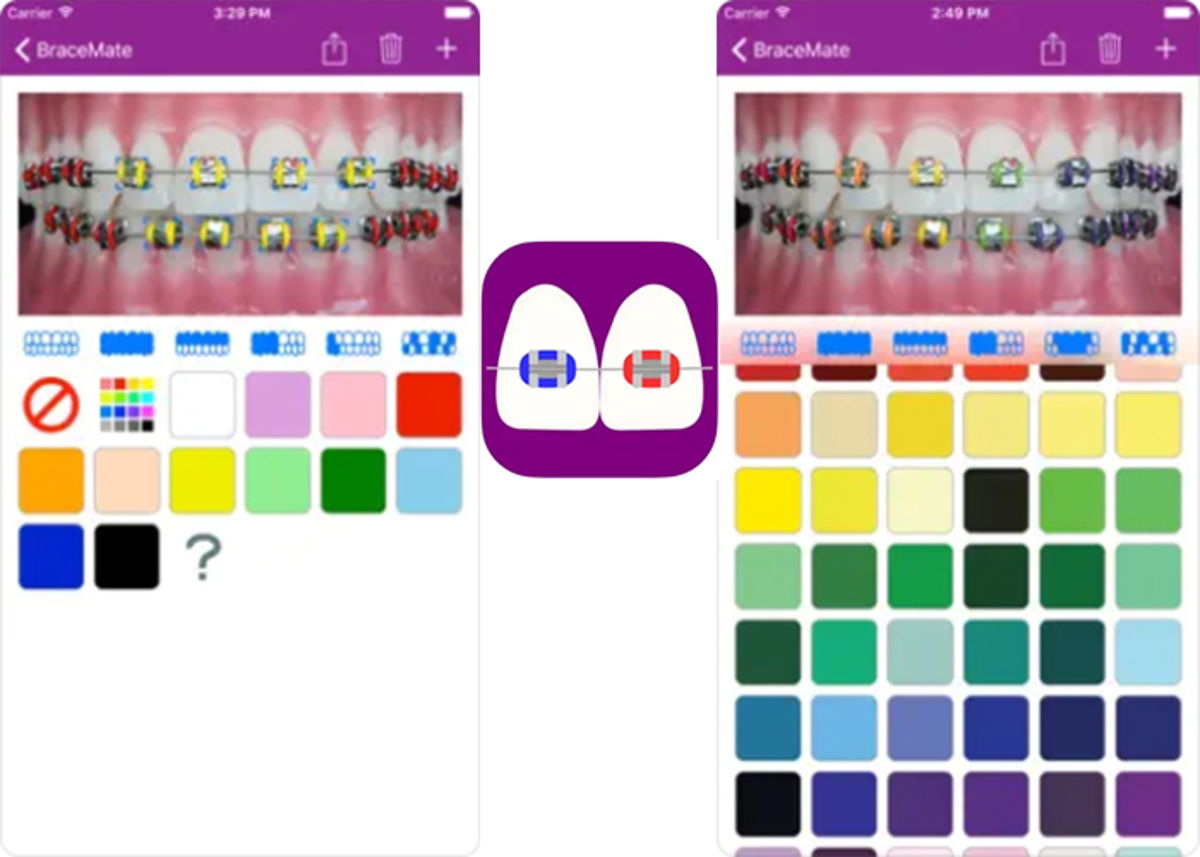 Las mejores apps simuladores de brackets disponibles para iPhone